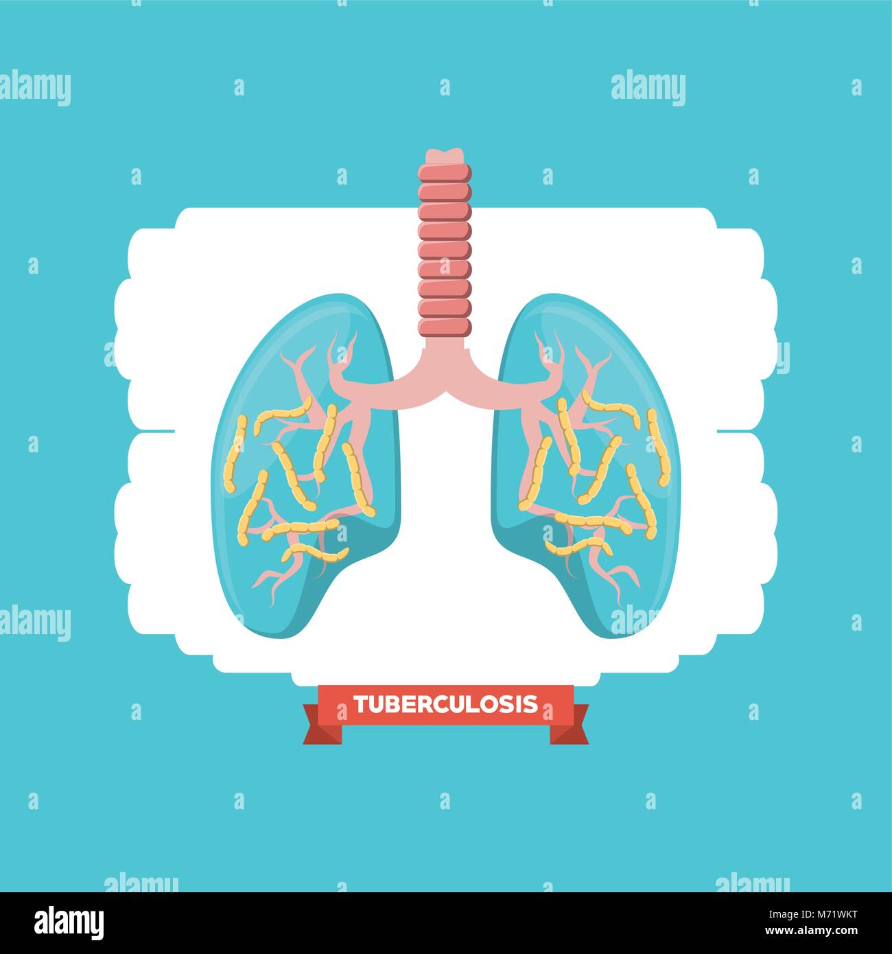 Lungs with tuberculosis bacterias over white and blue background ...