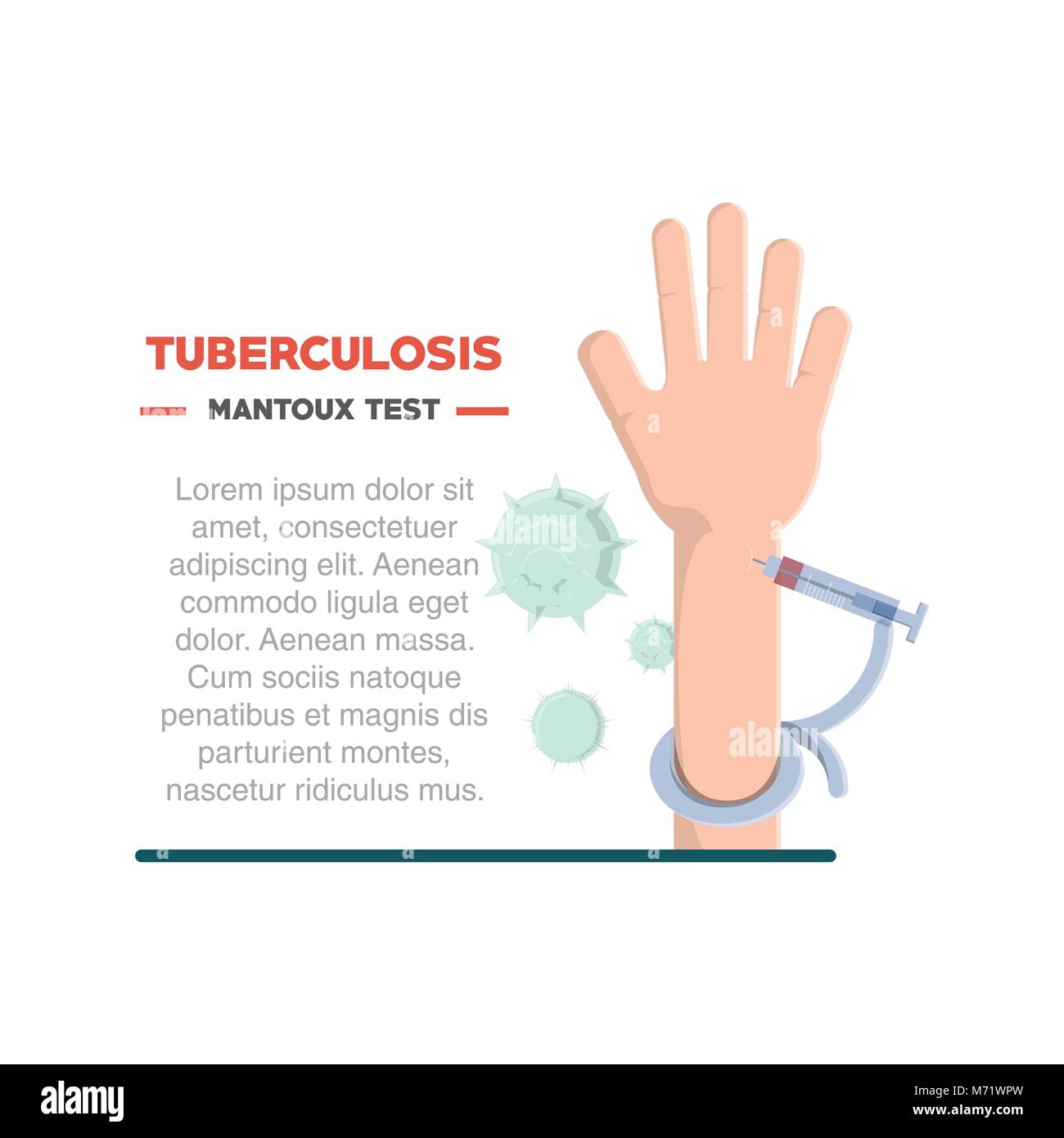 Tuberculosis infographic design with hand with mantoux test over white ...