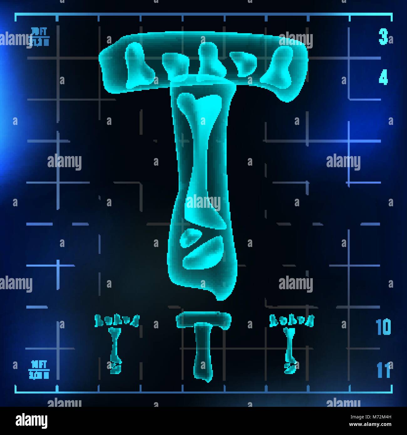 T Letter Vector. Capital Digit. Roentgen X-ray Font Light Sign. Medical ...