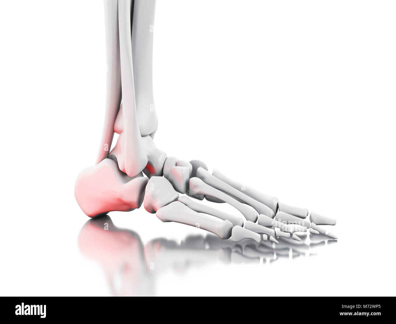 3d illustration. Painful ankle on white background. Medicine concept ...