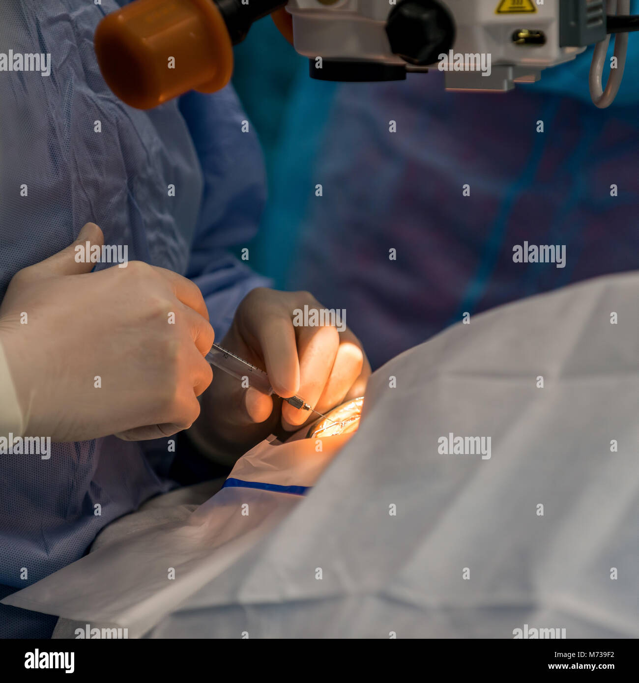 Doctors are in the process of conducting surgical operations on the eye ...