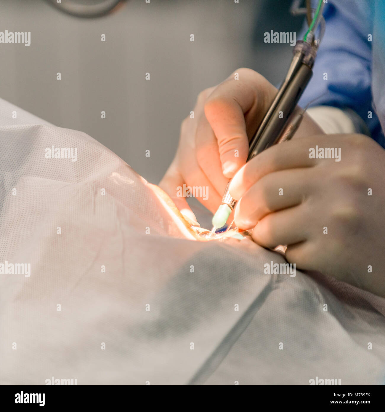 Doctors are in the process of conducting surgical operations on the eye ...