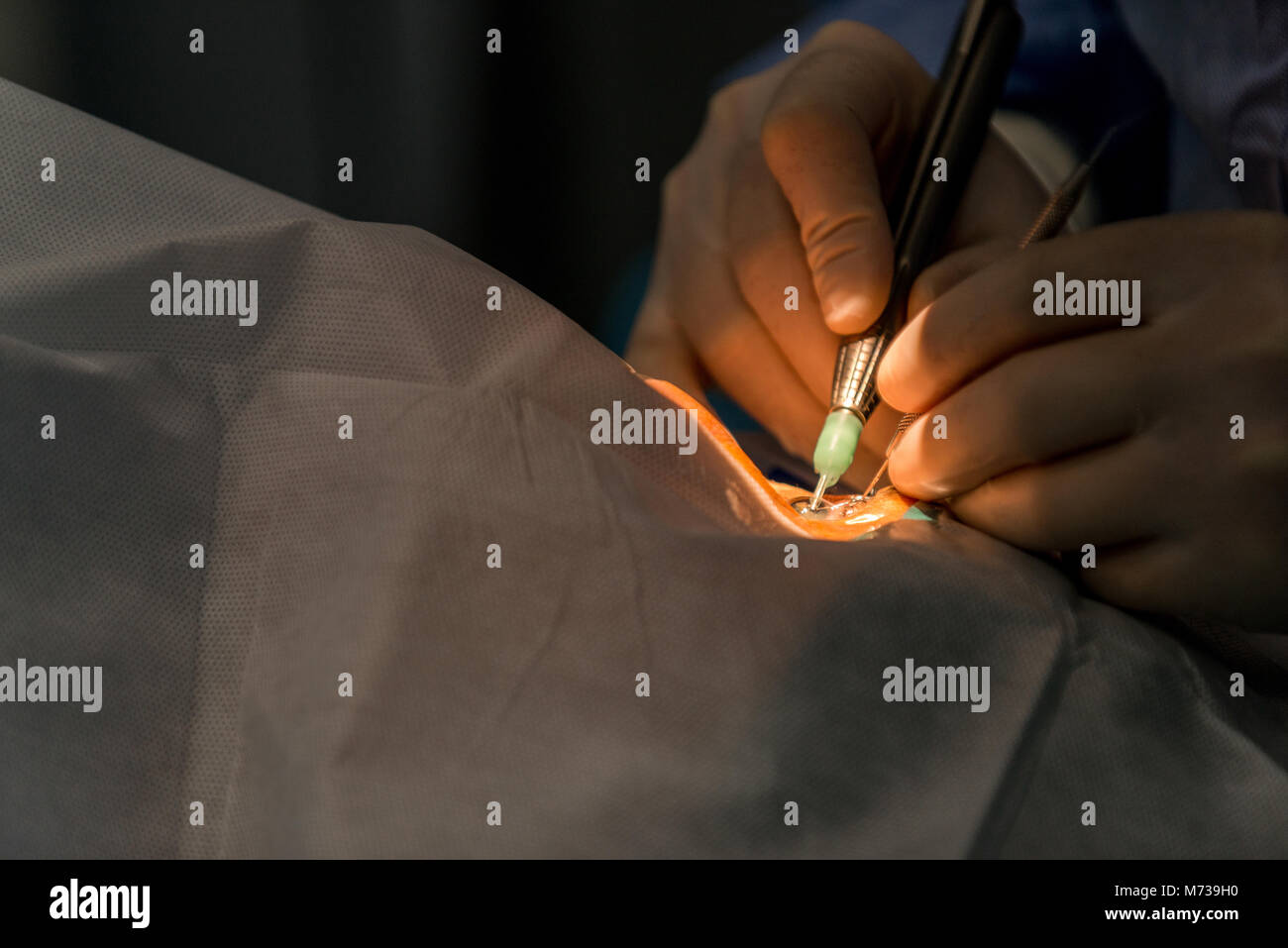 Clinic ophthalmic surgery hi-res stock photography and images - Alamy