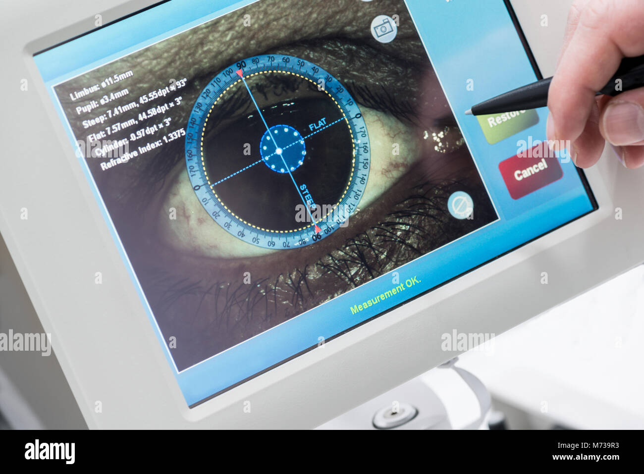 the doctor controls the oculist display with a scanned eye. diagnostic ...