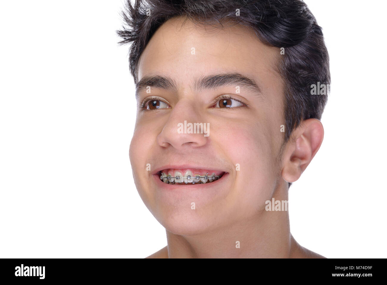 Male braces hi-res stock photography and images - Alamy