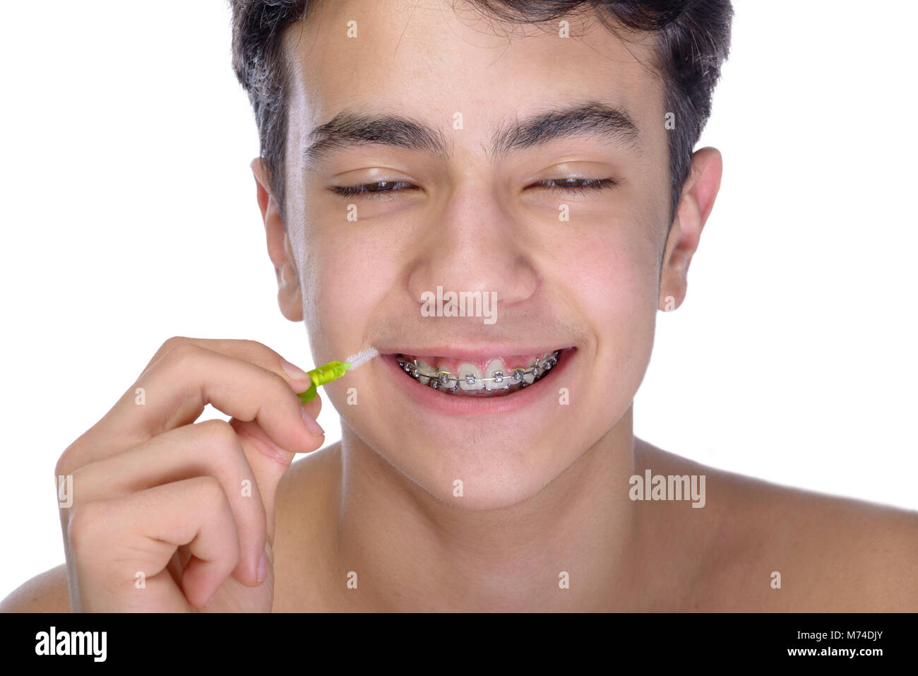 Boy with braces hi-res stock photography and images - Alamy