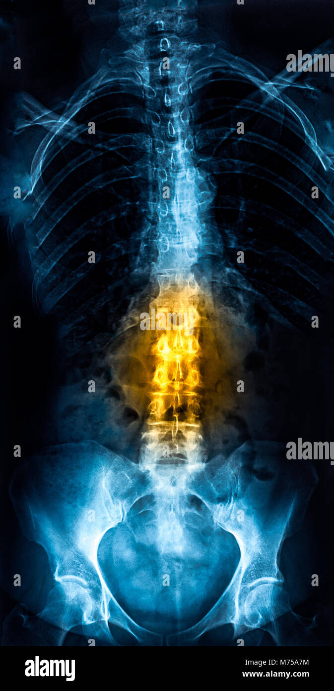 Anatomy of the lumbosacral spine hi-res stock photography and images ...