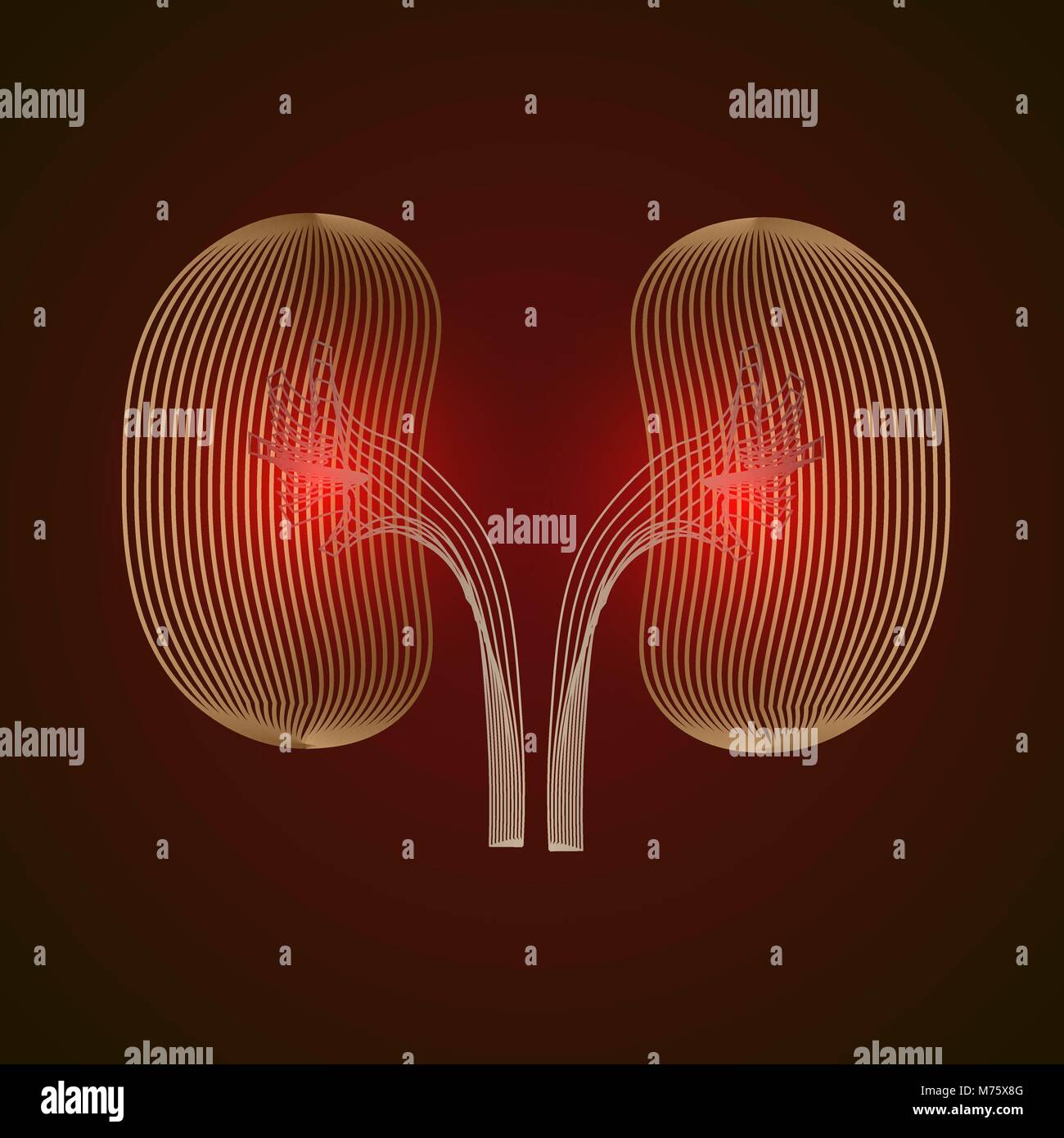 kidney disease silhouette icon. Pyelonephritis. Urolithiasis disease ...