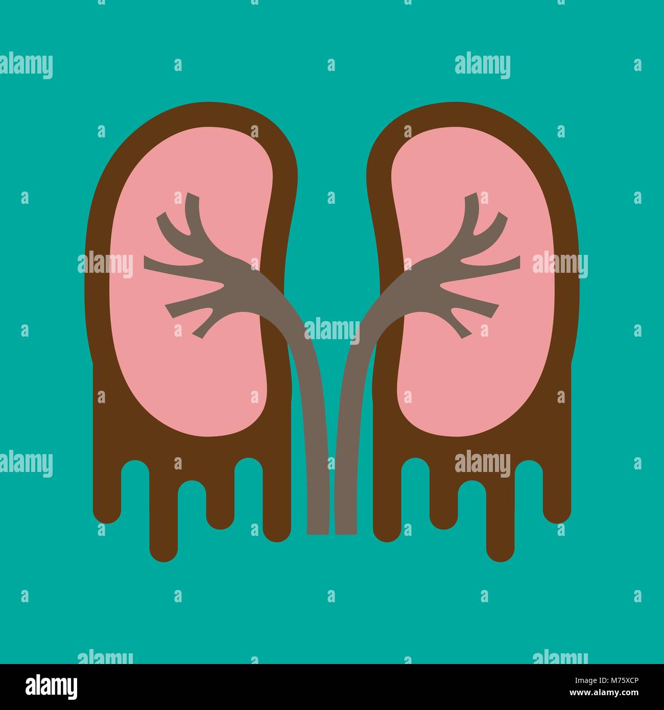 human organs kidney anatomy medical icon. Pyelonephritis. Urolithiasis ...