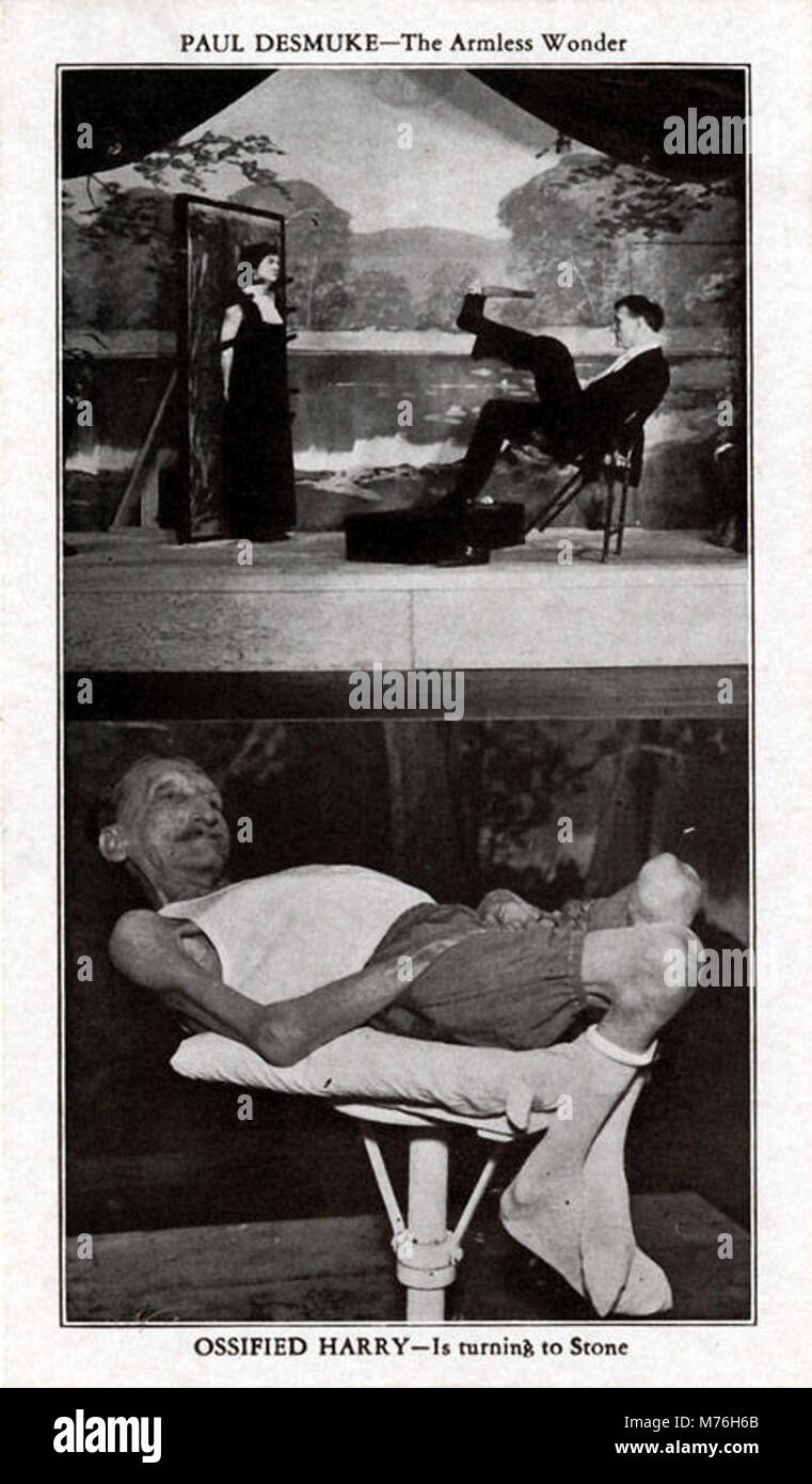 A photograph of Paul Desmuke, known as 'The Armless Wonder,' and ...