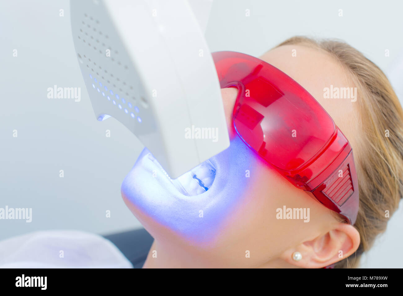 In the middle of getting her teeth whitened Stock Photo - Alamy