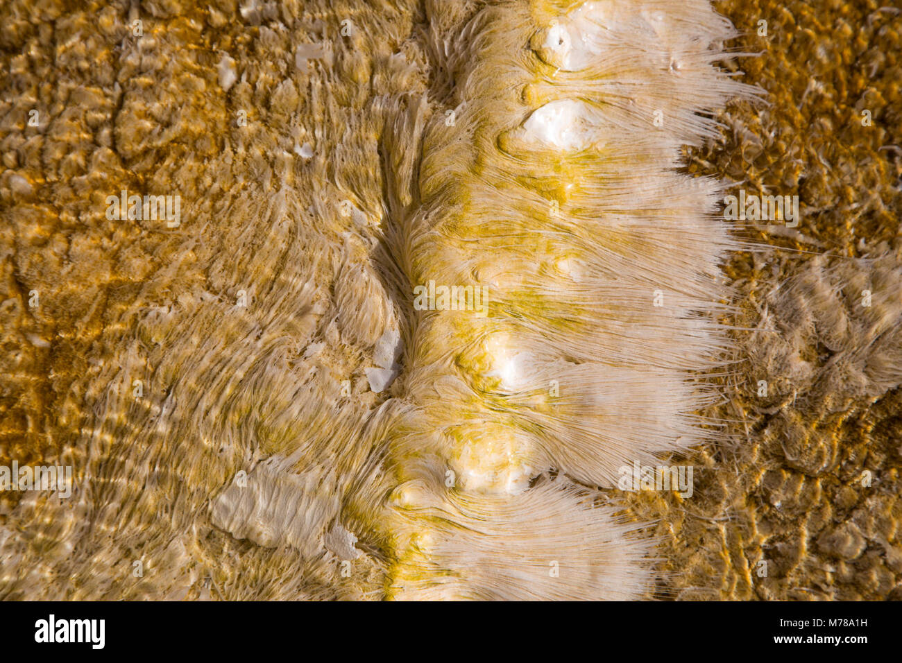 Filamentous bacteria hi-res stock photography and images - Alamy
