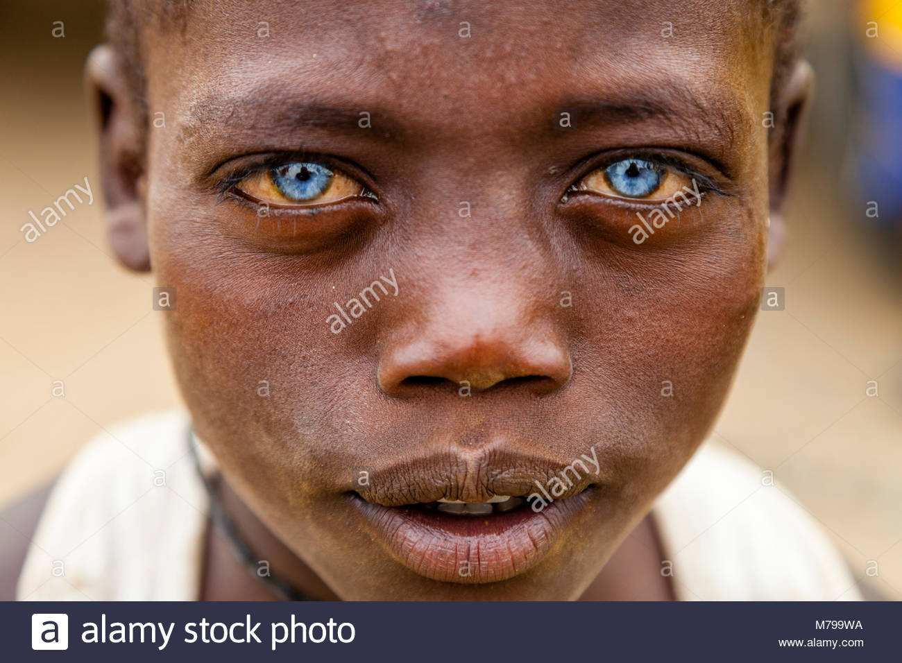 Ethiopian Child Stock Photos & Ethiopian Child Stock Images - Alamy