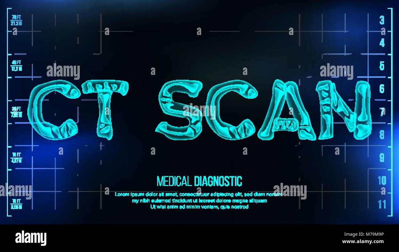 CT Scan Banner Vector. Medical Background. Transparent Roentgen X-Ray ...