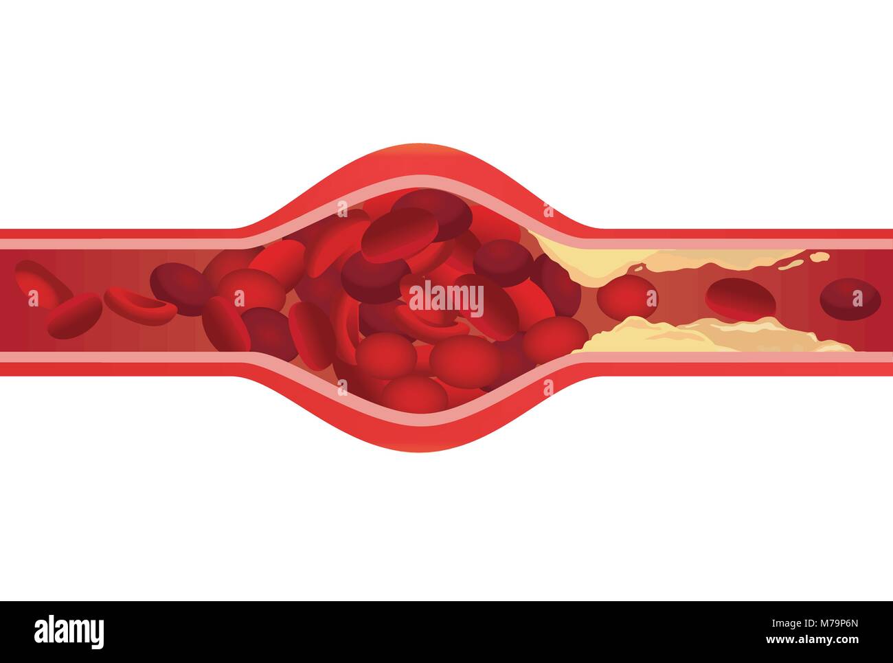 High fat Stock Vector Images - Alamy