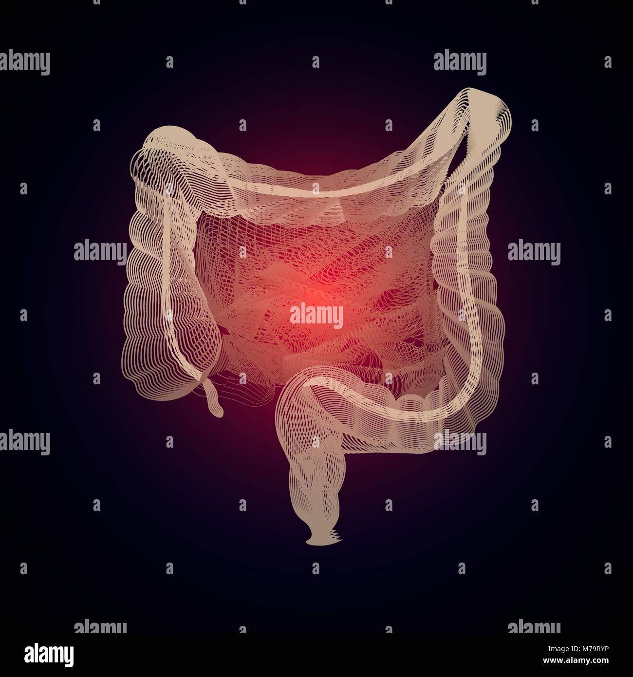 Vector isolated intestines with pain center. 3D human organ Medicine ...