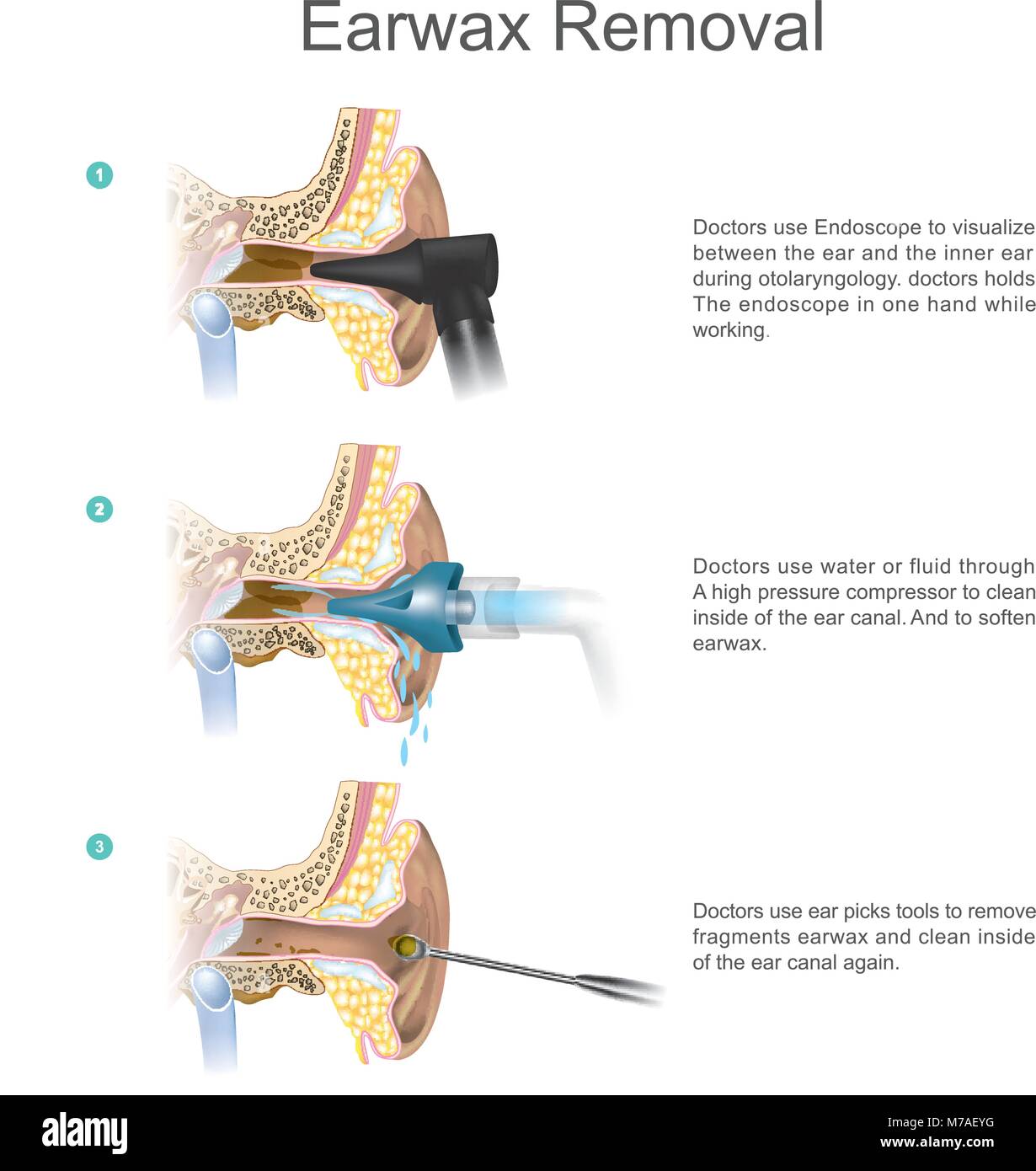 Ear Canal Water