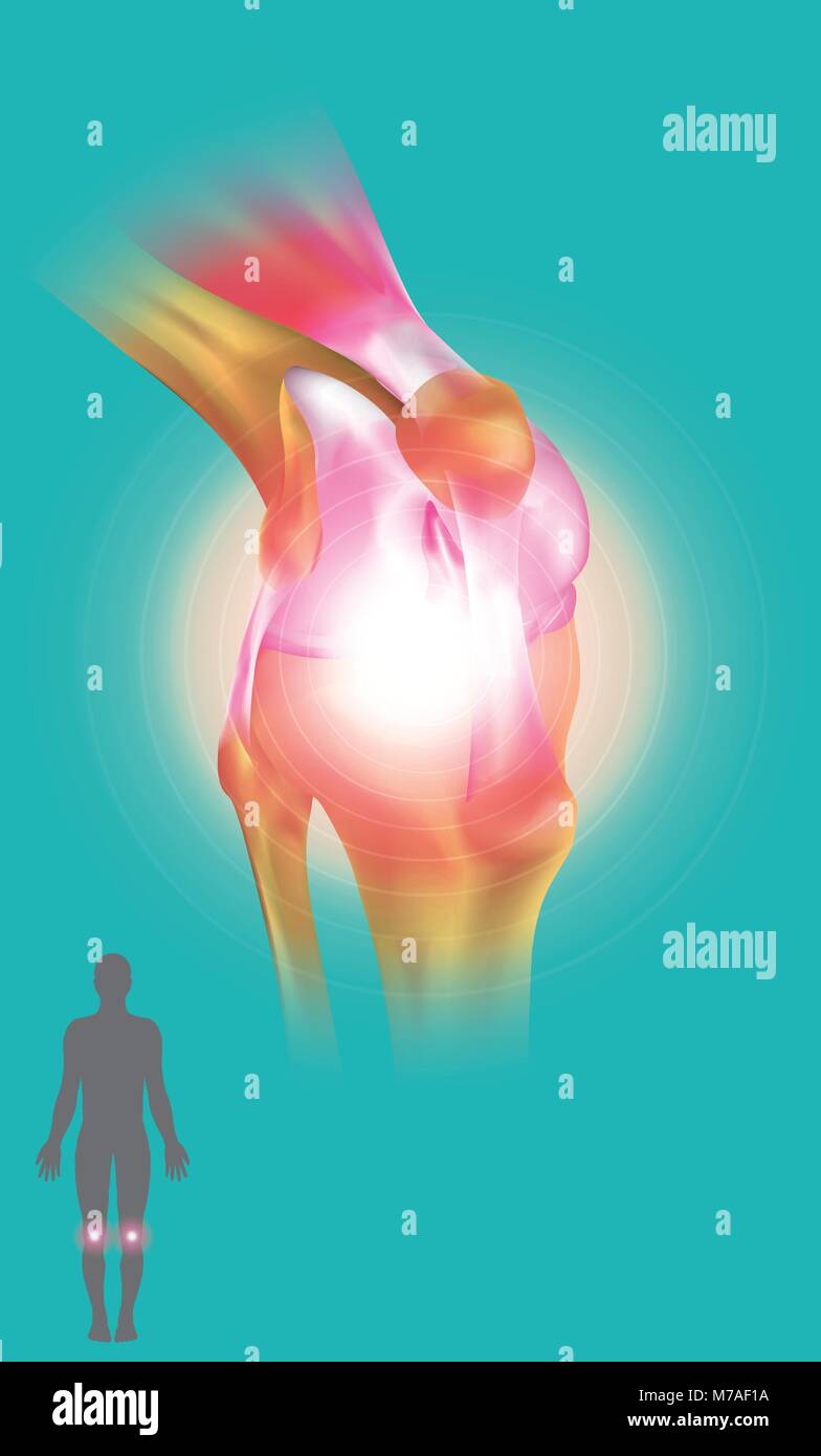 The knee joint joins the thigh with the leg and consists of two ...