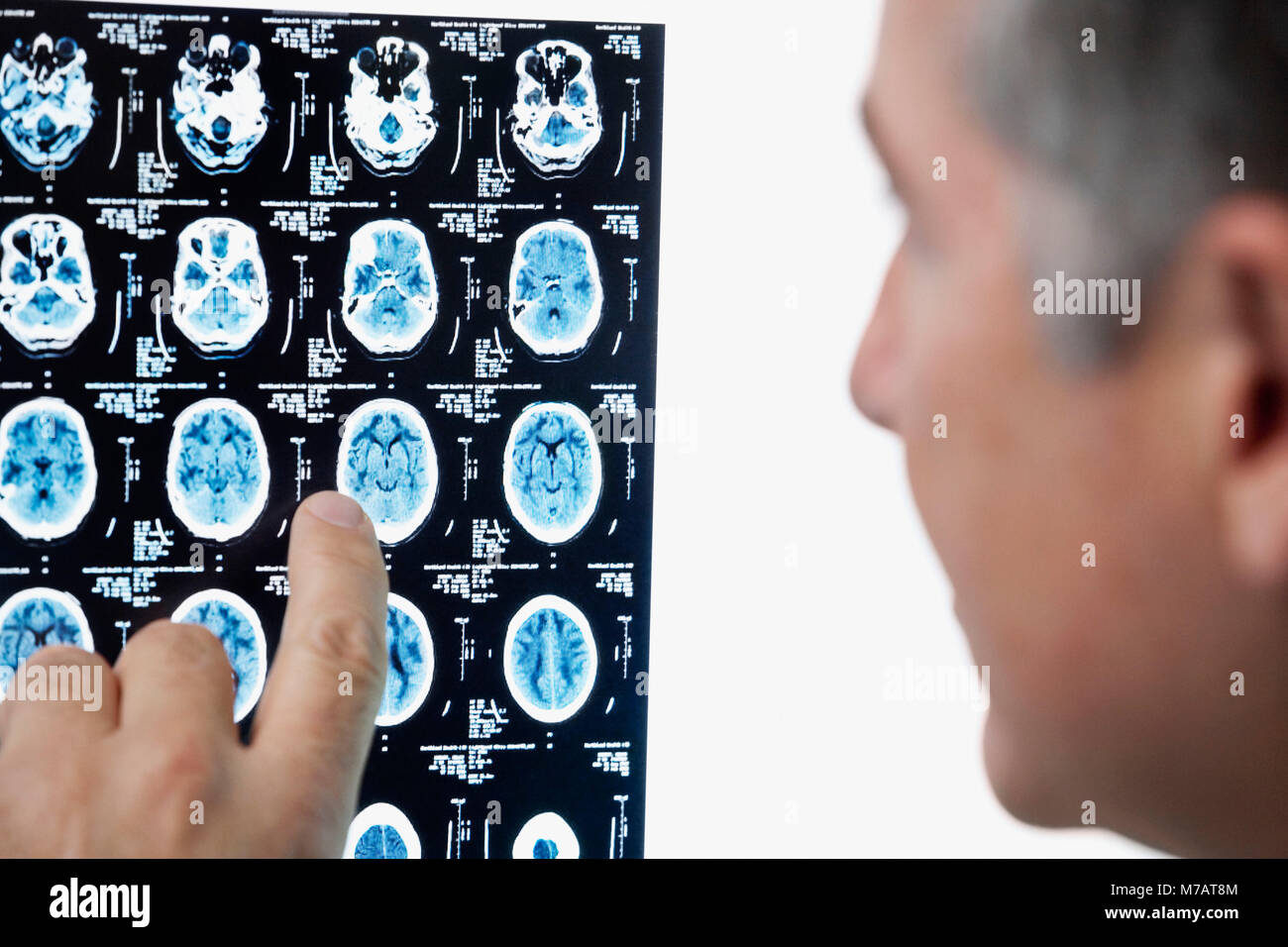Doctor examining MRI report Stock Photo - Alamy