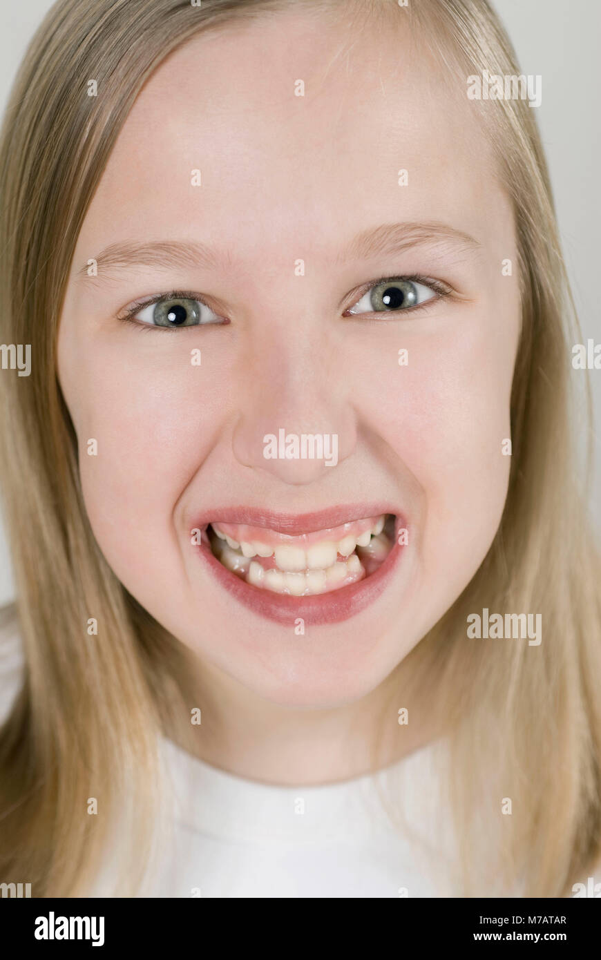 Portrait of a girl clenching her teeth Stock Photo - Alamy