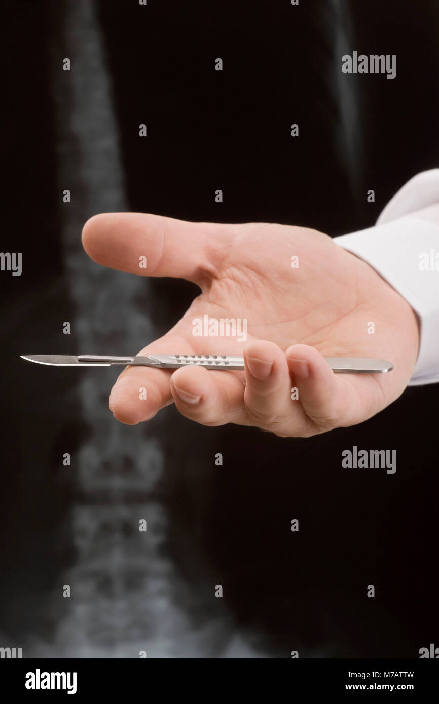 Close-up of a person's hand holding a scalpel Stock Photo - Alamy