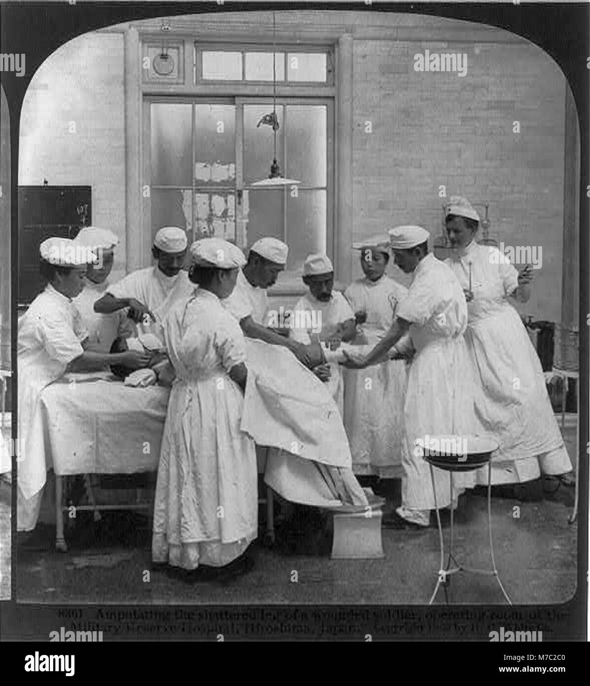 A photograph showing a soldier undergoing amputation in the operating ...