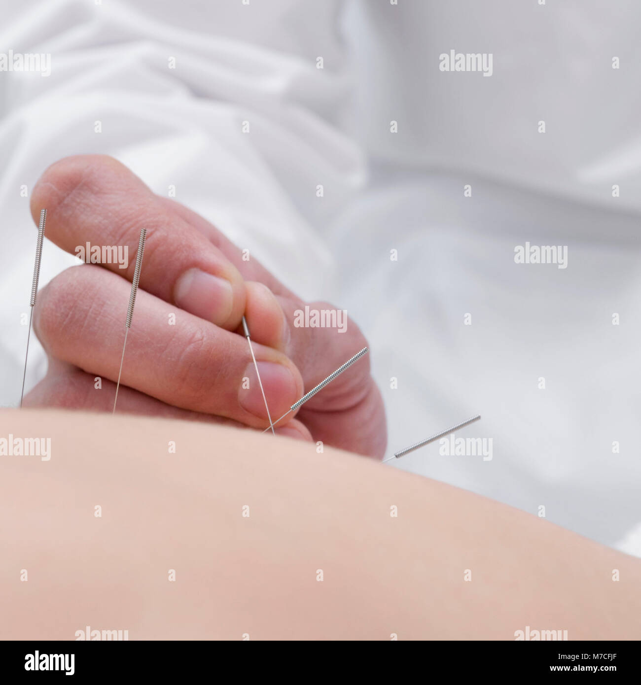 Body needles image hi-res stock photography and images - Alamy