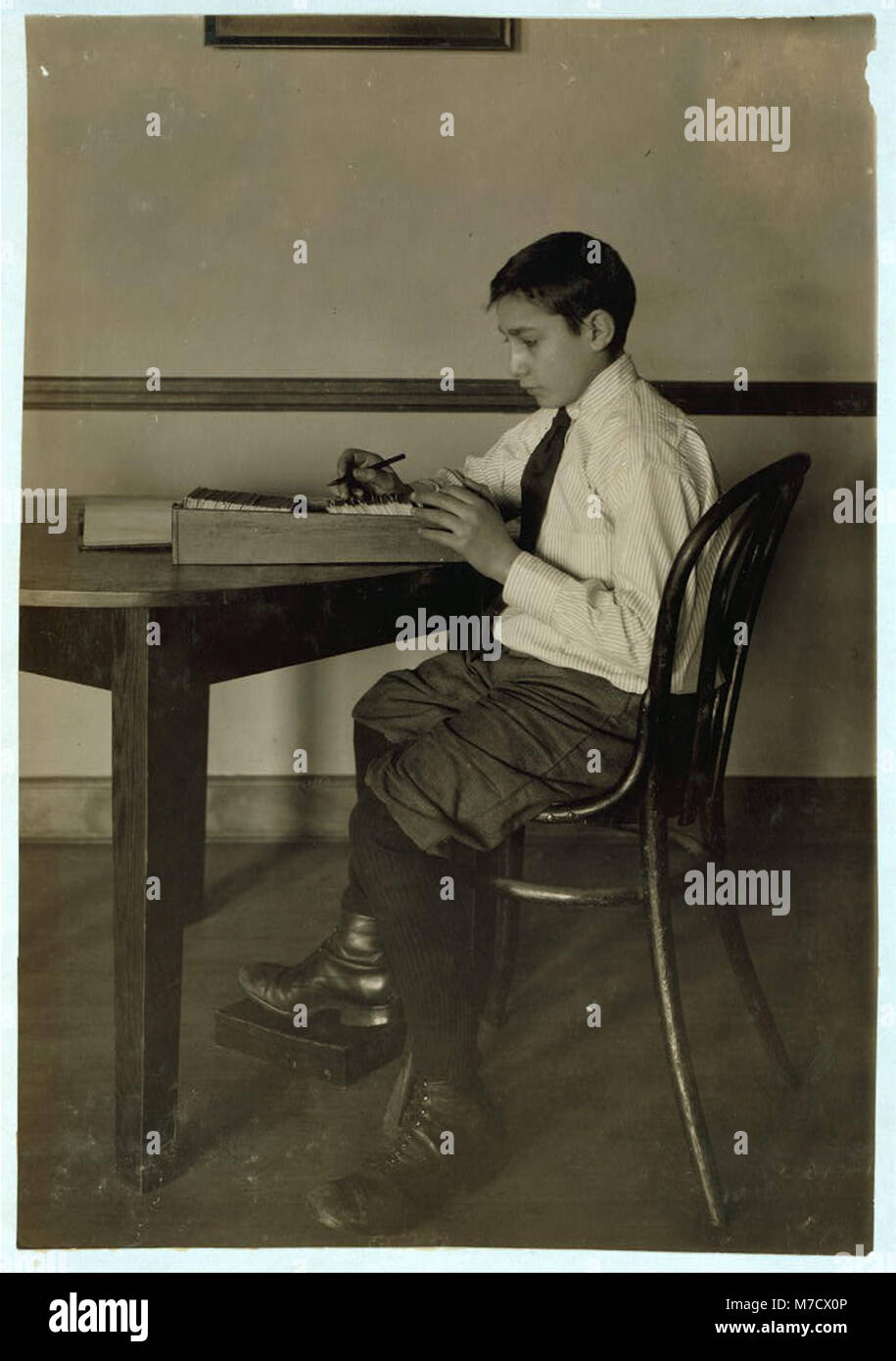 Favorable working position for this kind of physical defect. Foot ...