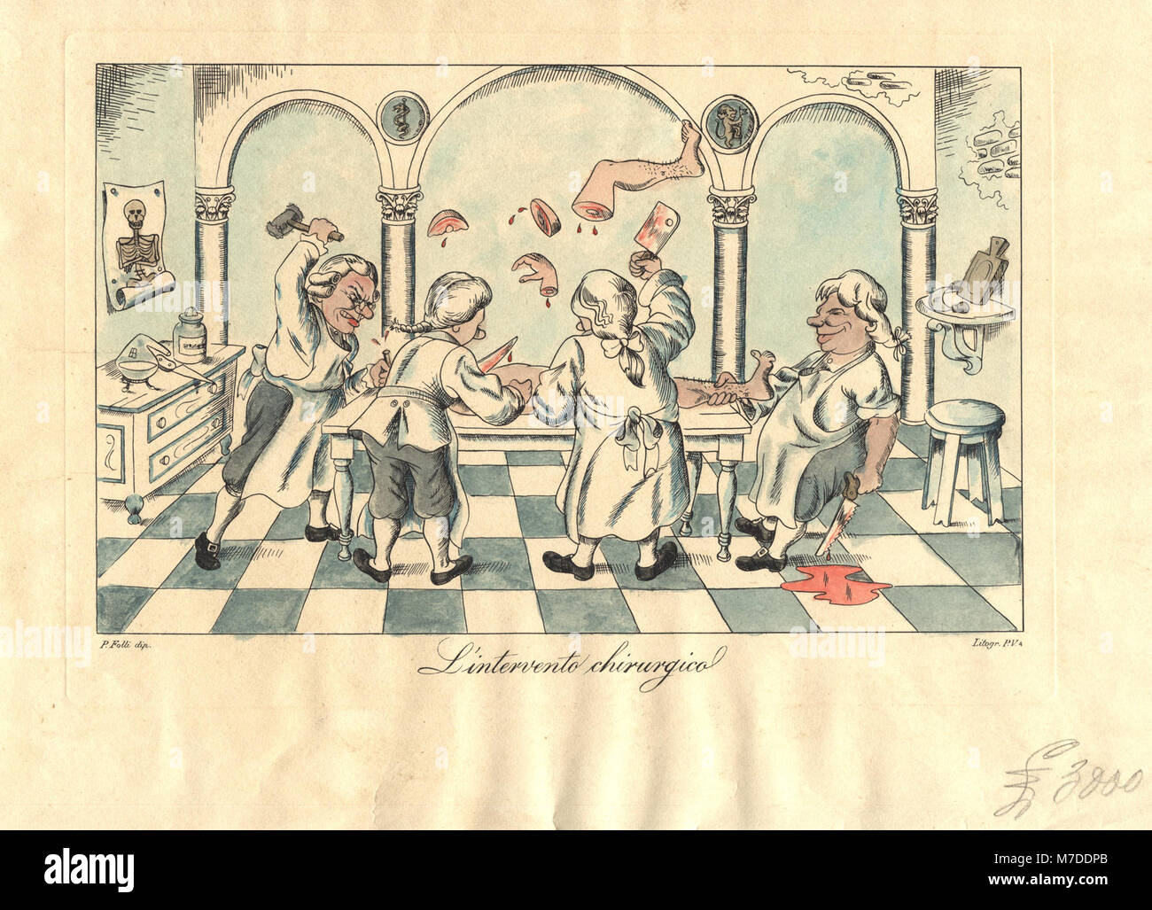 Surgical instruments 20th hi-res stock photography and images - Alamy