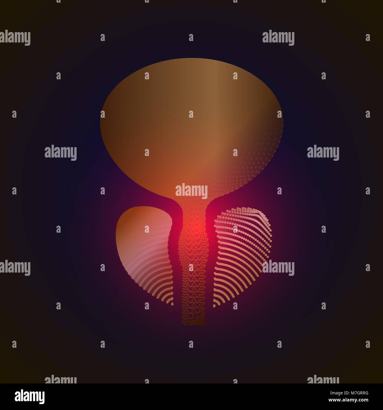 Prostatic adenoma x ray Stock Vector Images - Alamy