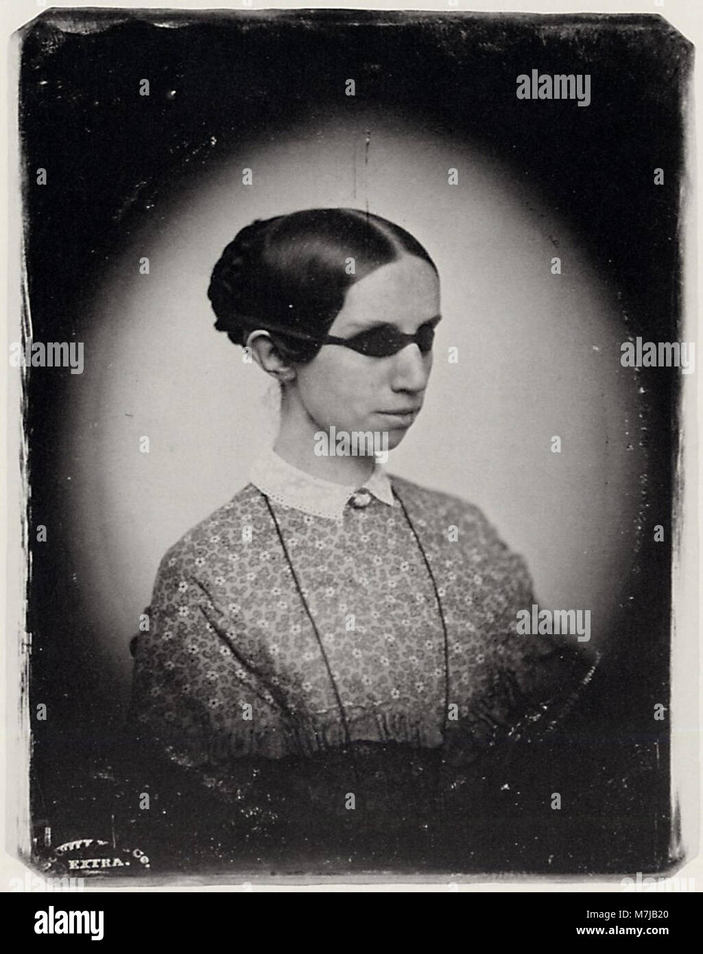 A portrait of Laura Dewey Bridgman, the first deaf-blind American to ...