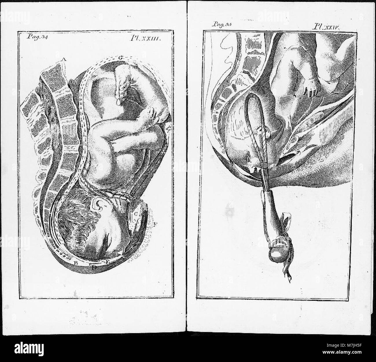 A depiction of childbirth, illustrating the process of labor and ...