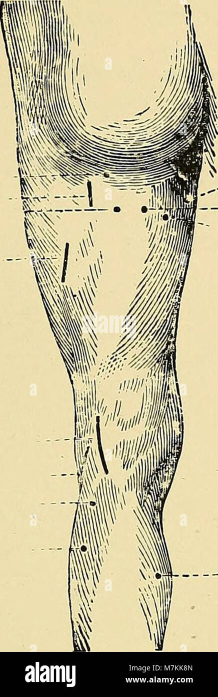 Finsen light hi-res stock photography and images - Alamy