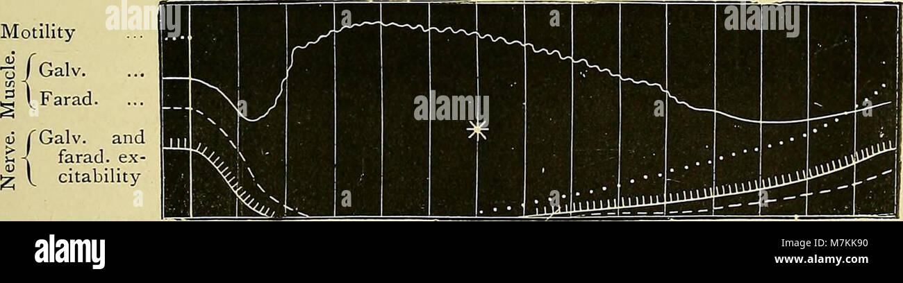 Finsen light hi-res stock photography and images - Alamy