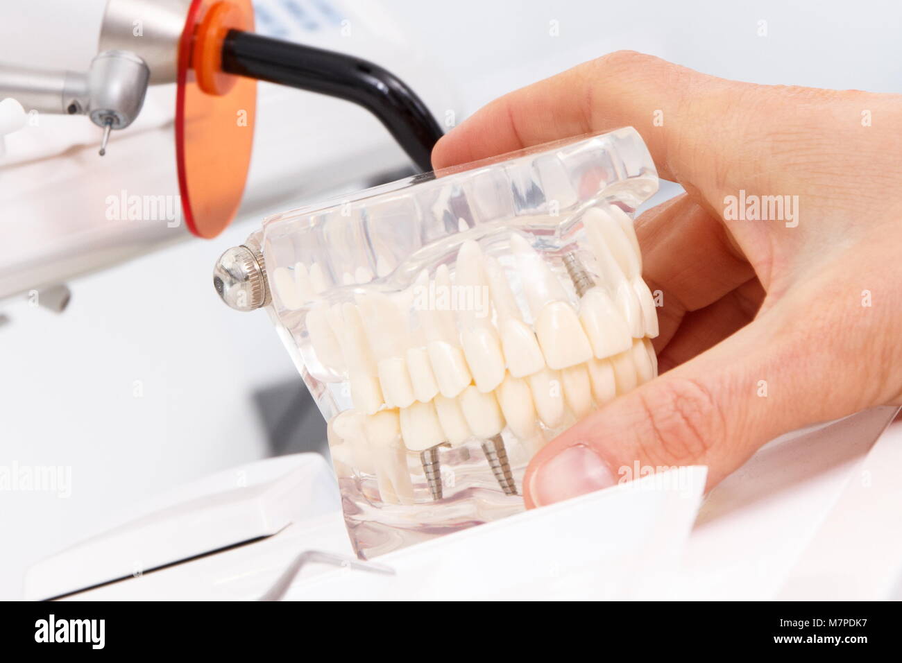 Model used by orthodontist hi-res stock photography and images - Alamy