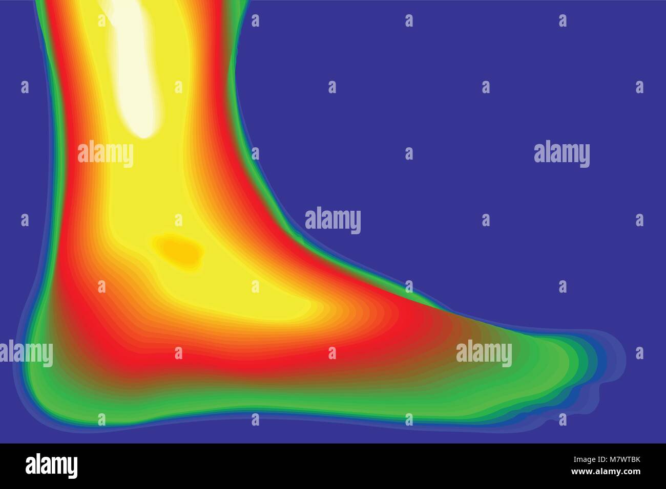 Human Leg vector illustration. Thermal imager, Infrared Thermograph ...