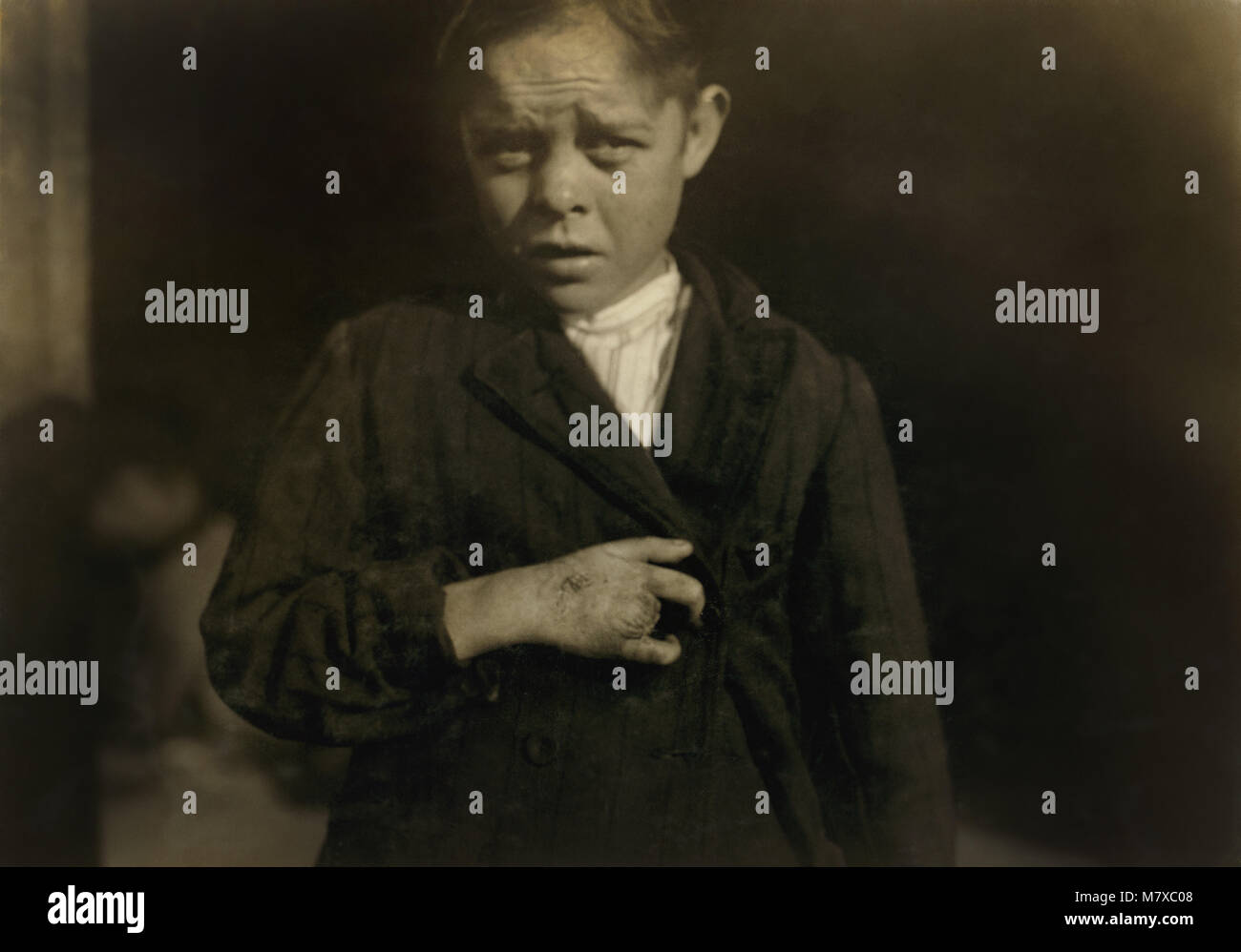 Giles Edmund Newsom, Young Cotton Mill Worker, 12 years old, Fell on to ...