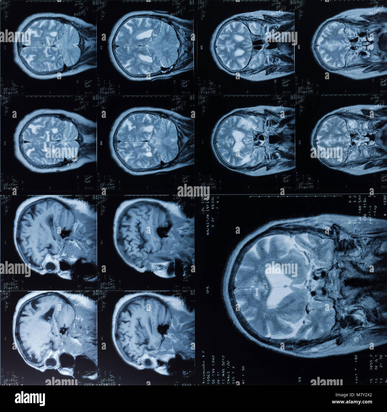 Head MRT. MR image of human brain Stock Photo - Alamy