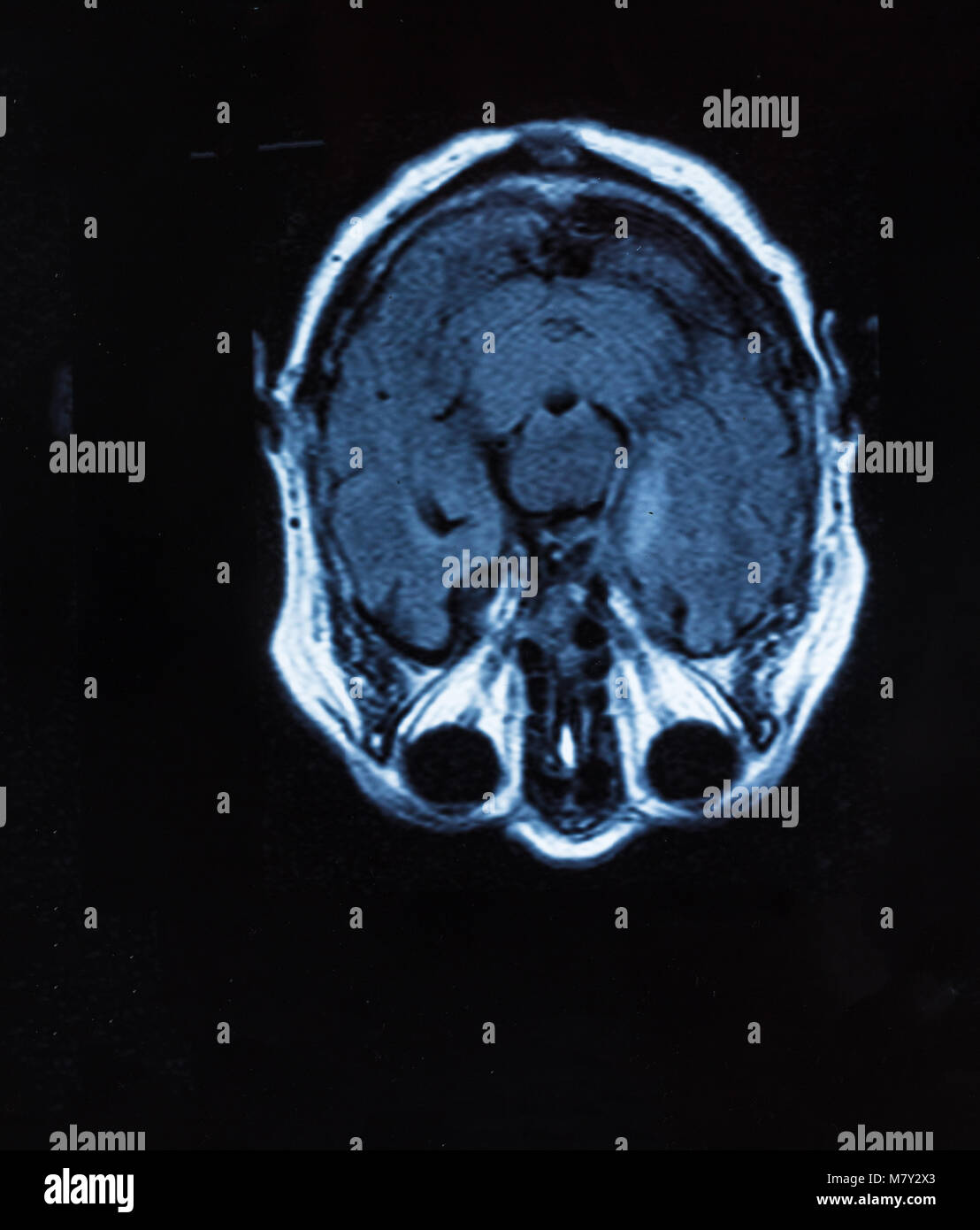 Head MRT. MR image of human brain Stock Photo - Alamy