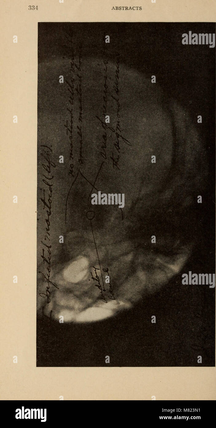 The Buffalo Medical Journal (1913) presents a compilation of medical ...