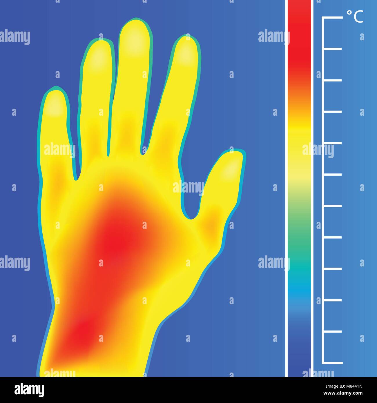 Thermograph hi-res stock photography and images - Alamy