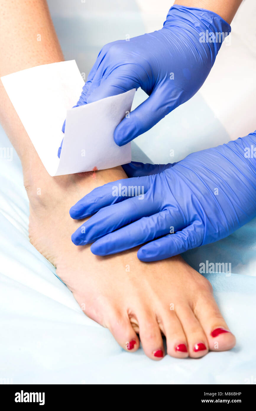 The process of classical wax depilation of female limbs in the beauty ...