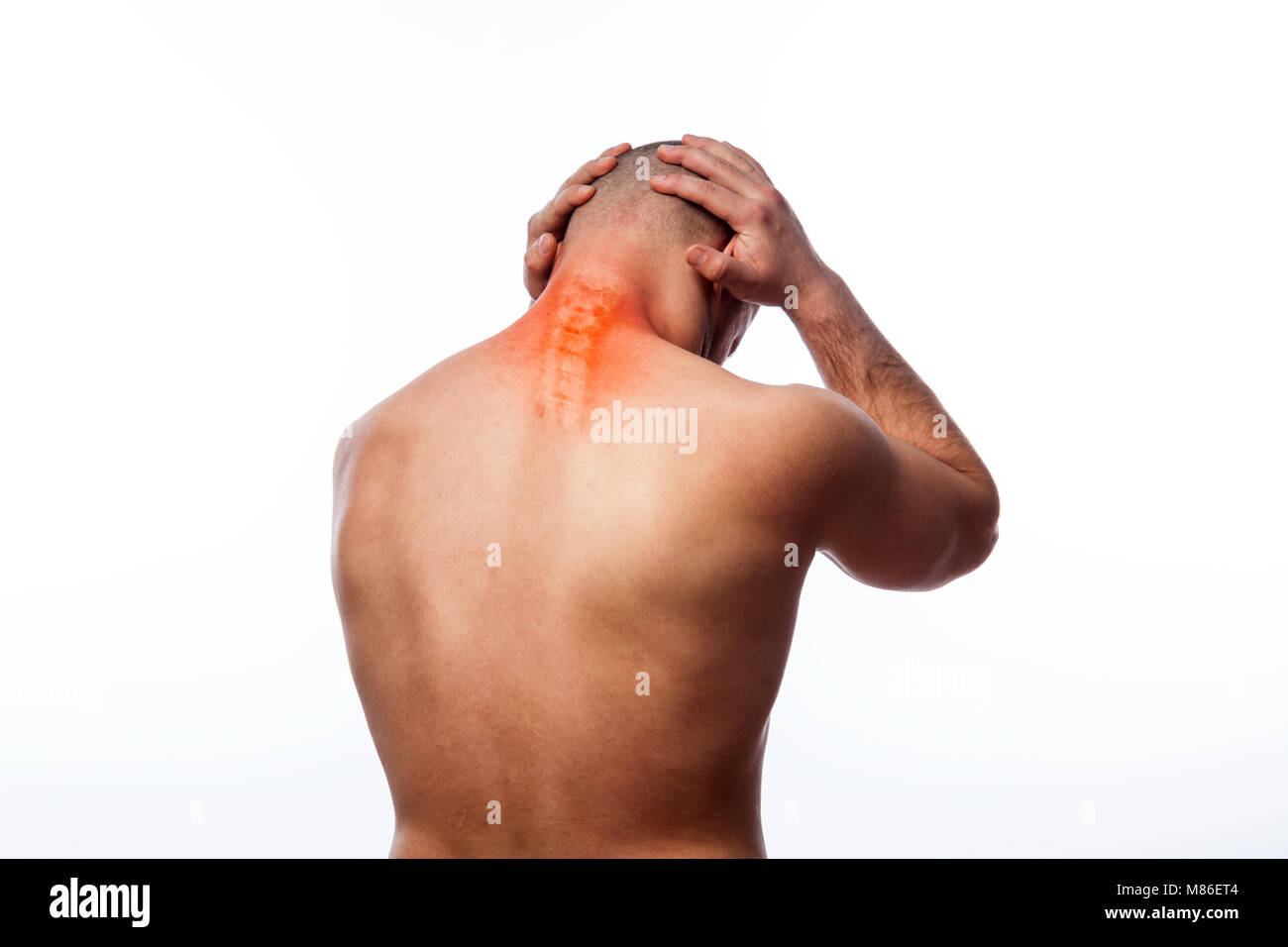 Pain in the neck. Young bald man sports physique holds a sick neck on a ...