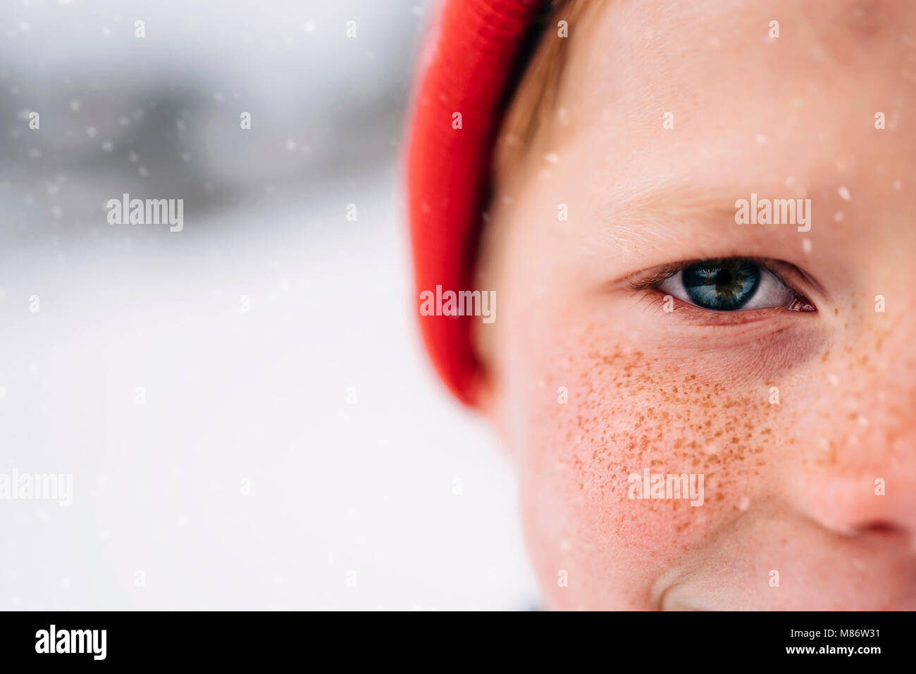 Close-up of a boy with freckles standing in snow Stock Photo - Alamy