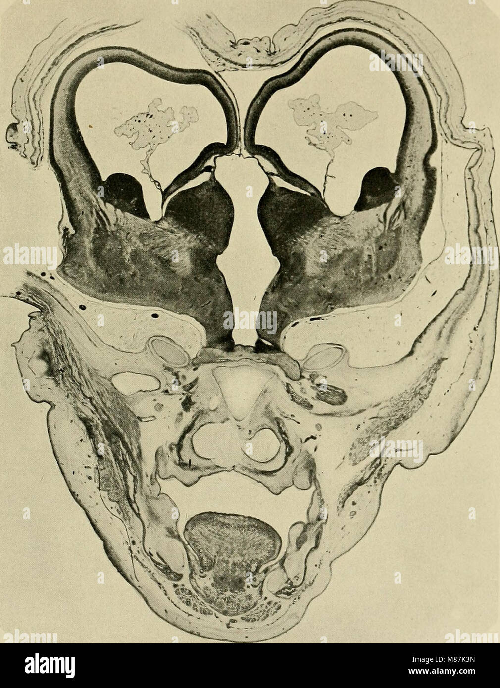 This 1904 study examines the development of the human brain during the ...