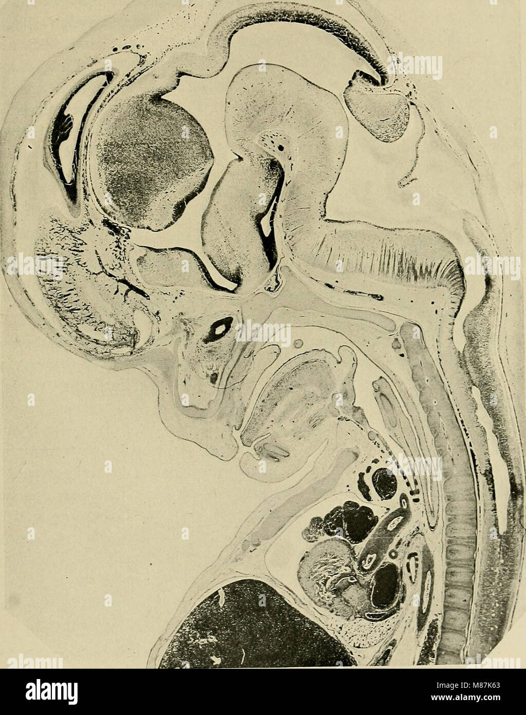 This 1904 study examines the development of the human brain during the ...