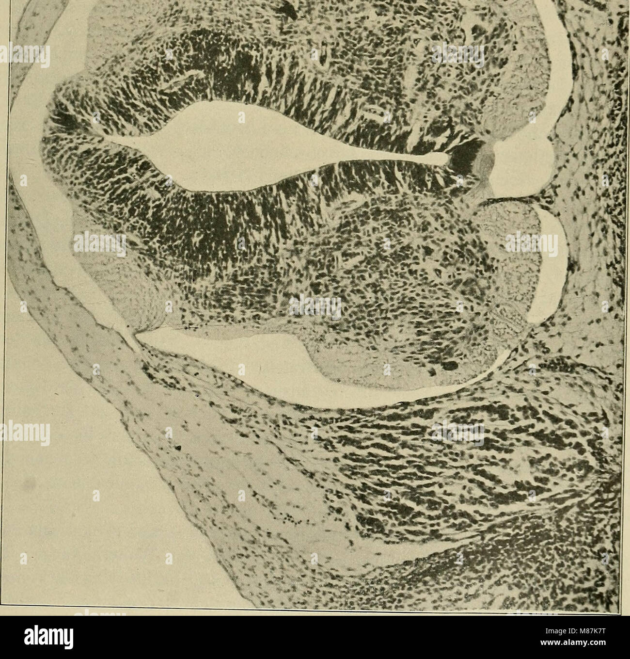 This 1904 German study focuses on the development of the human brain ...
