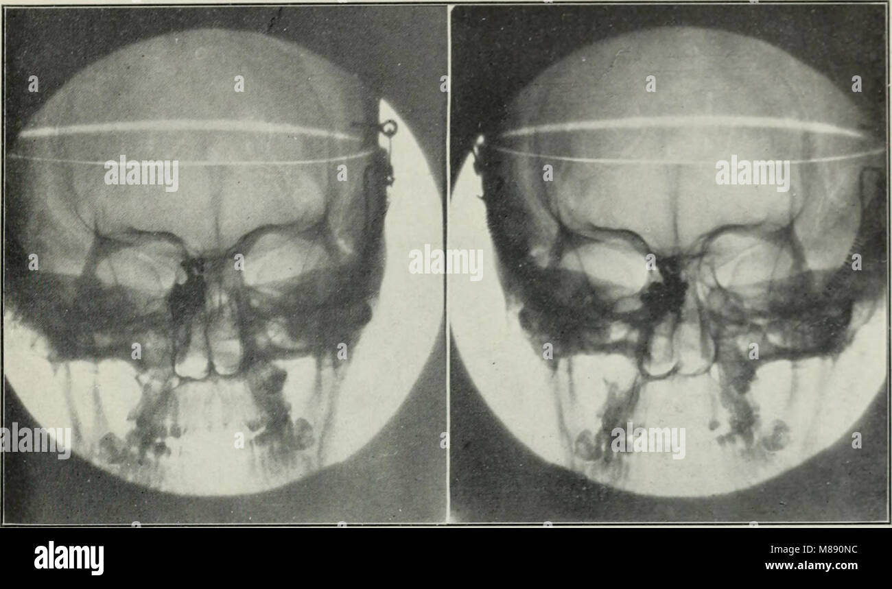 This 1813 work explores the techniques of elementary and dental ...