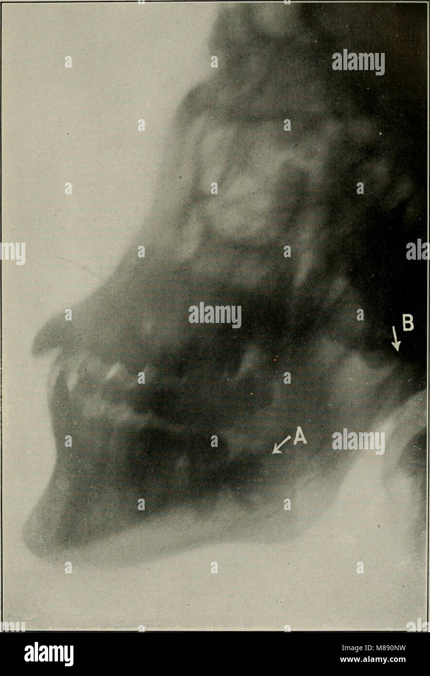 Diagnostic insights hi-res stock photography and images - Alamy