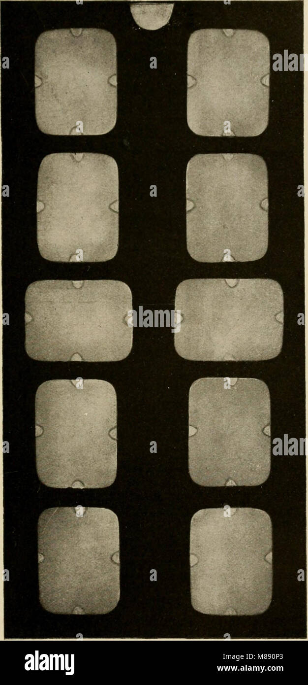Elementary and dental radiography by howard riley raper 1918 hi-res ...